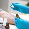 Skin Patch Testing Dermatology Florida- Coastal Skin Surgery